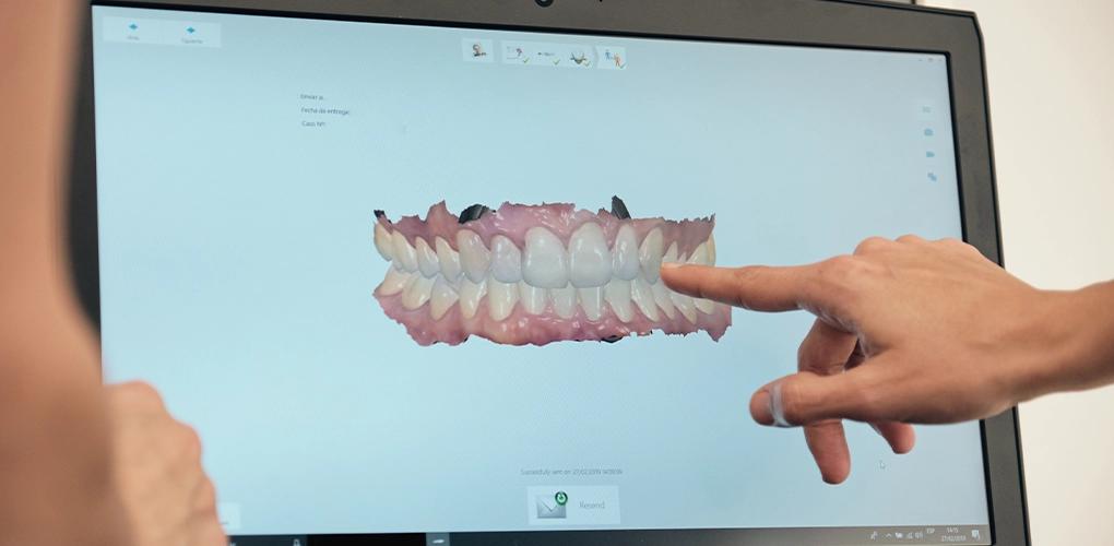 Digital Smile Design (DSD) in Dubai - DentalZorg